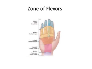JOURNAL CLUB ON FLEXOR TENDON INJURIES.pptx