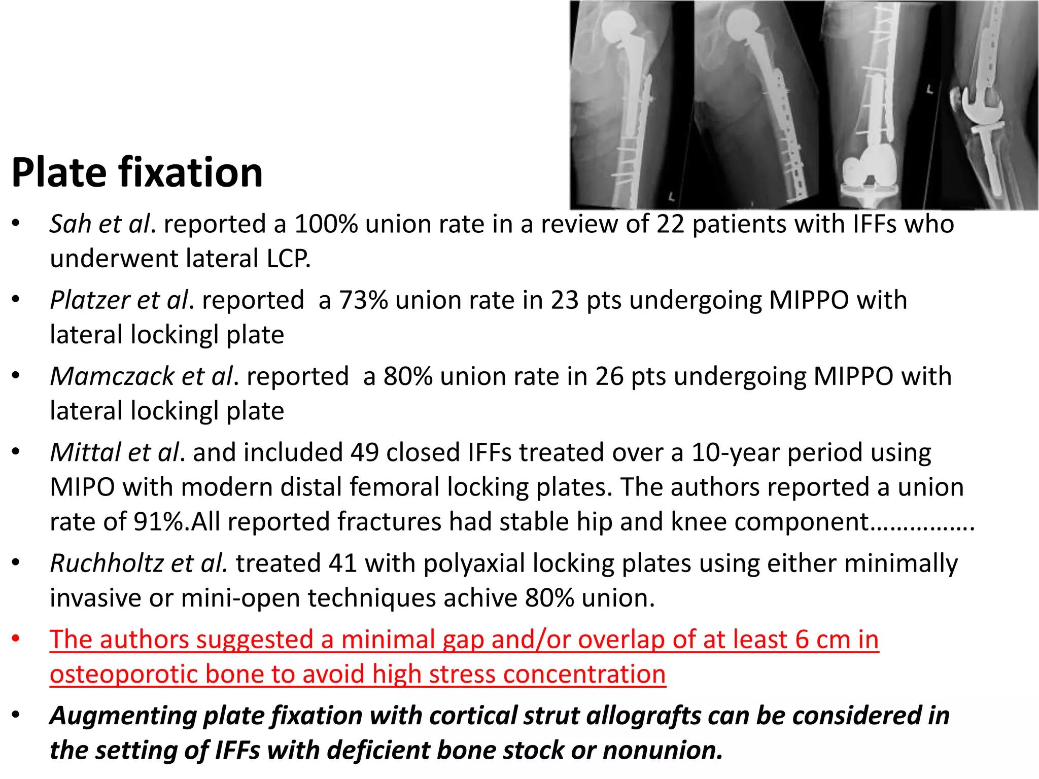 Journal club on IFF.pptx