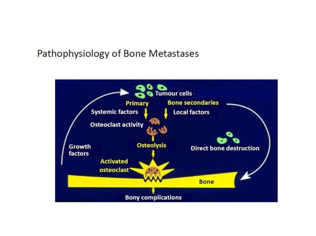 Pathologic Fractures due to metastasis and its management .pptx