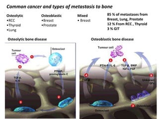 Pathologic Fractures due to metastasis and its management .pptx