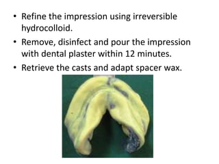 Journal club on physiological impression techniques | PPTX | Dental ...