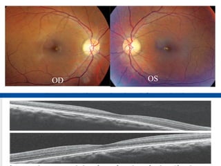 Clinical Visual Electrophysiology | PPT