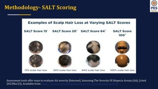 Journal Club Presentation On Barcitinib For Alopecia Areata Pptx