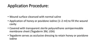Journal Club comparison of dressings.pptx