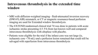 Journal Club Thrombolysis.pptx