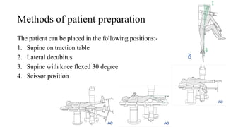 journal dr Abhishek highly specific topic for reduction technique in ...