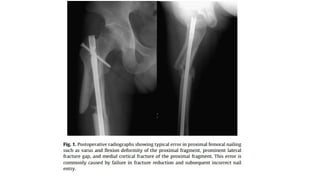 journal dr Abhishek highly specific topic for reduction technique in ...