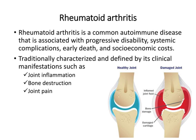 The immunopathogenesis of seropositive rheumatoid arthritis | PPT