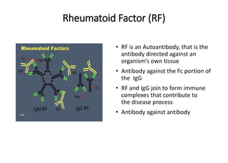 The immunopathogenesis of seropositive rheumatoid arthritis | PPTX