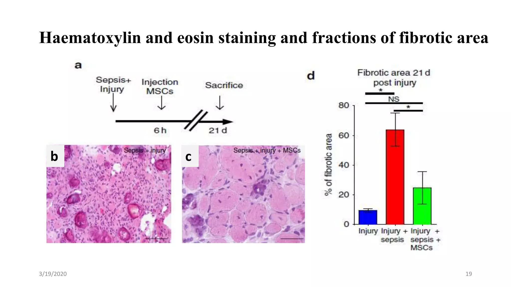 Sepsis Induces Long-term Metabolic and Mitochondrial Muscle Stem Cell ...