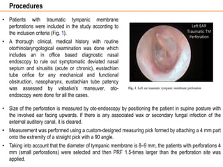 journal presentation on traumatic Tympanic membrane perforations.pptx