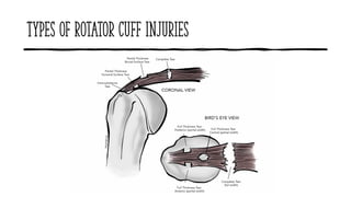 Journal presentation on Conservative Management of Partial Articular ...
