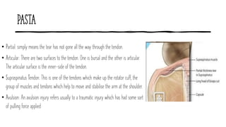 Journal presentation on Conservative Management of Partial Articular ...