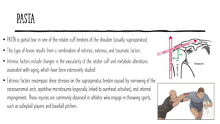 Journal presentation on Conservative Management of Partial Articular ...