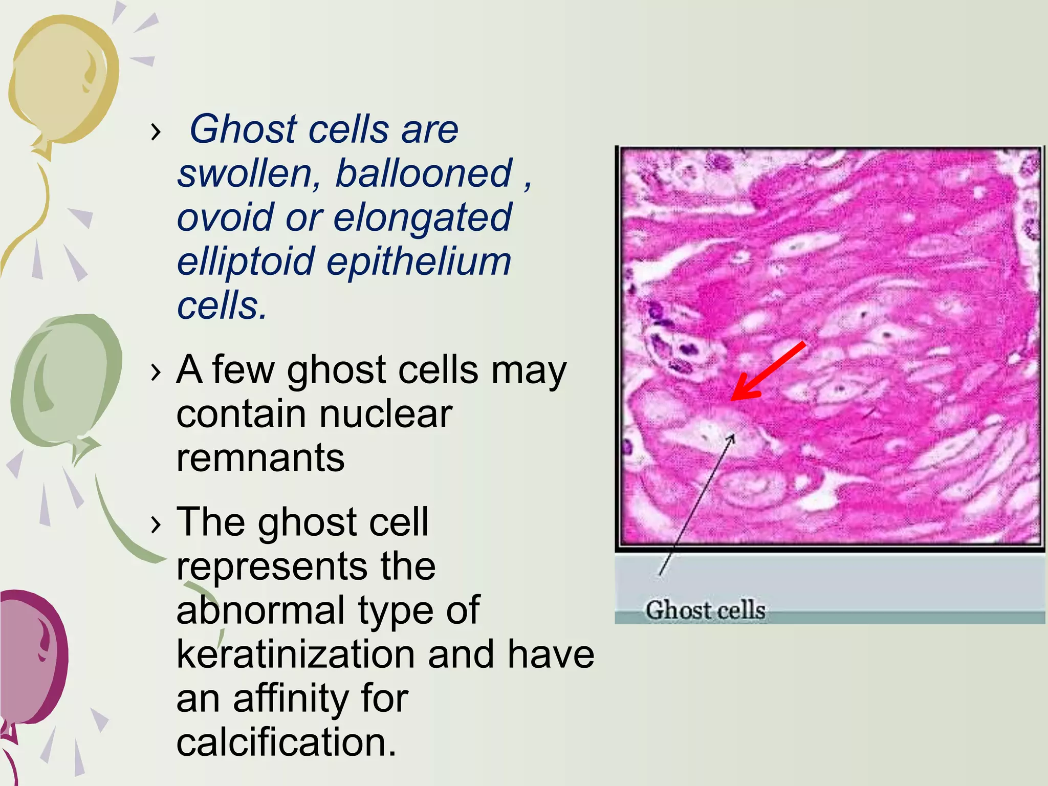 calcifying odontogenic cyst | PPTX