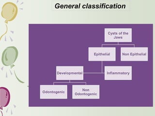 calcifying odontogenic cyst | PPTX