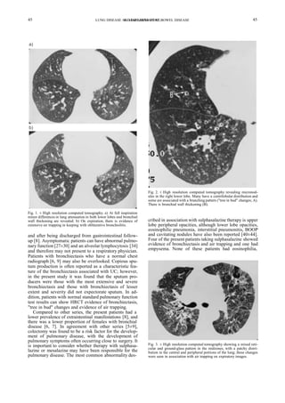 (Journal Reading) Aulia Dwi.docx