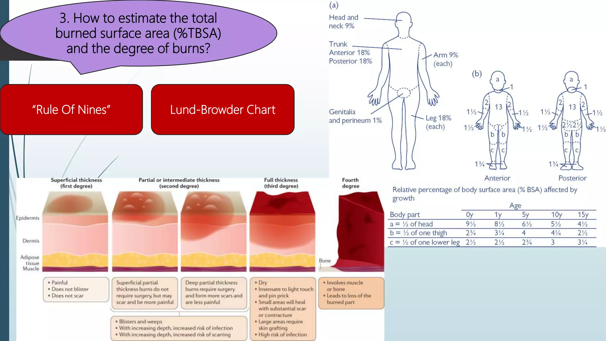 Treatment of burns in the first 24 hour.pptx