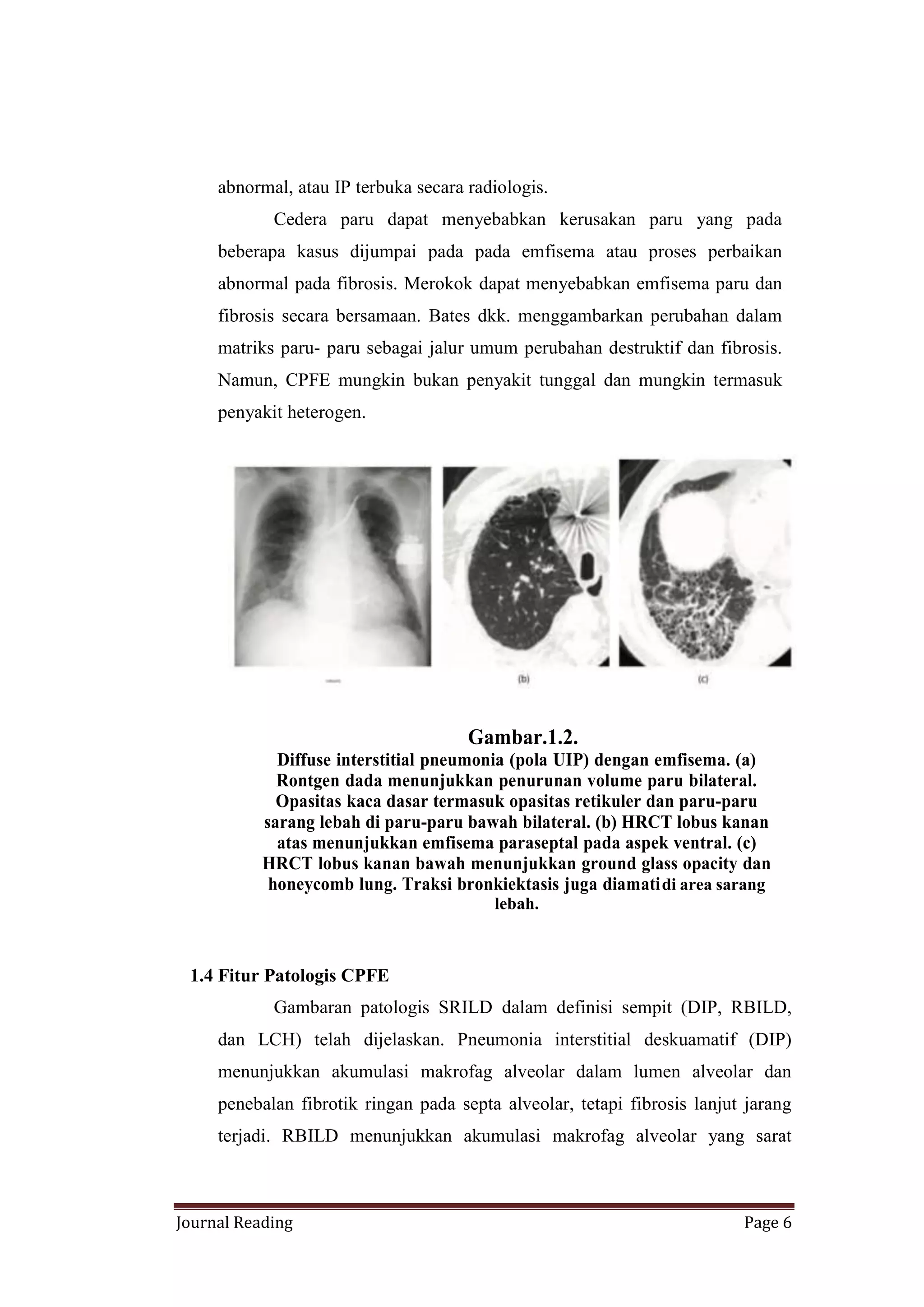 JOURNAL READING fix.docx