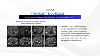Journal Reading HCC Extrahepatic. Tinjauan pustakapptx | PPT