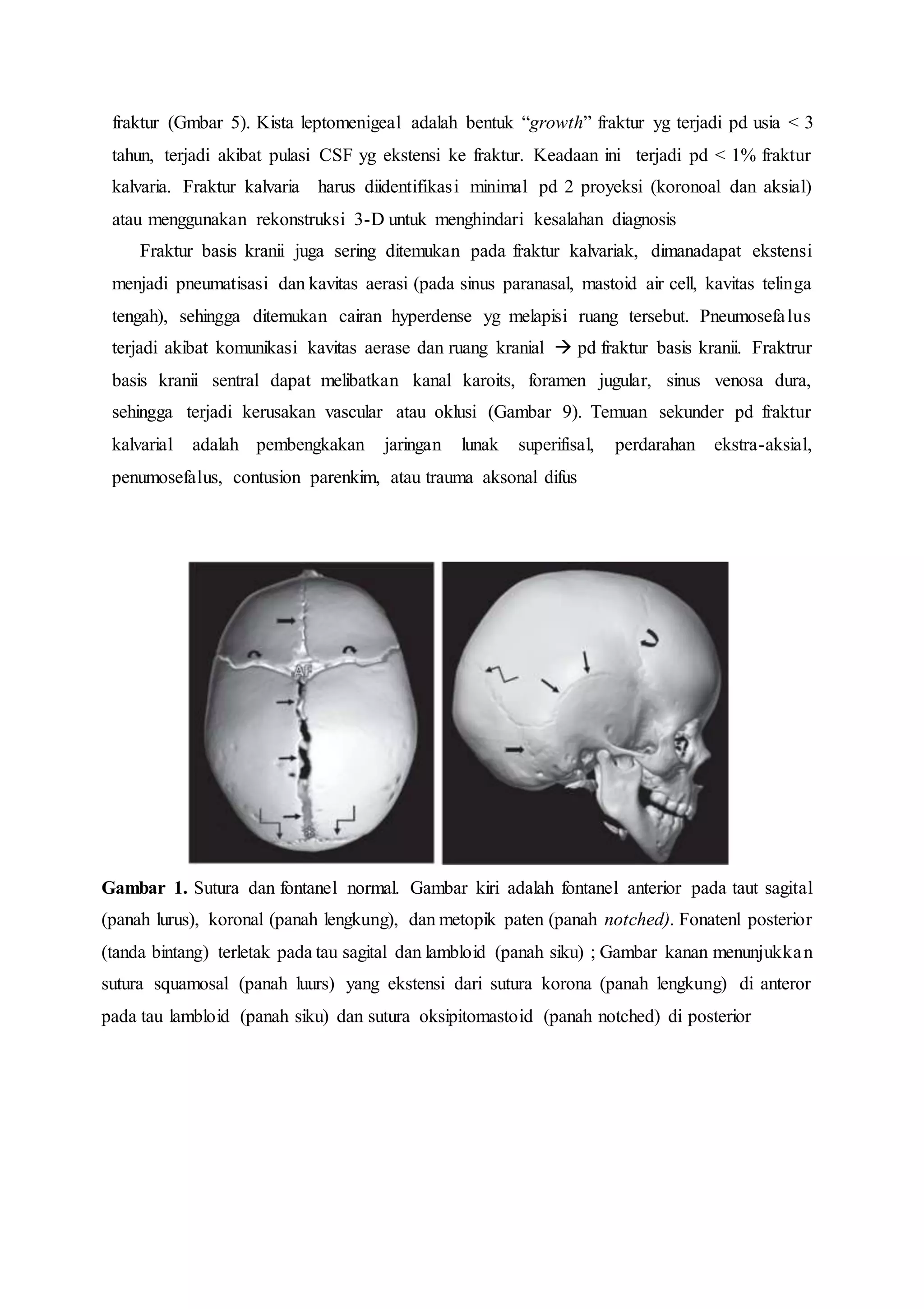 Imaging pediatric head trauma-Indonesia Version | DOCX