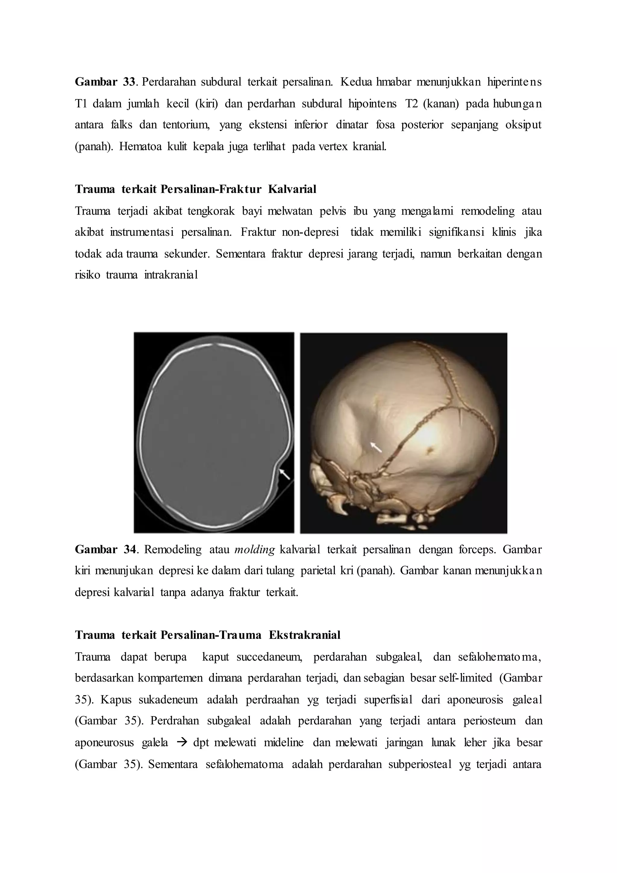 Imaging pediatric head trauma-Indonesia Version | DOCX