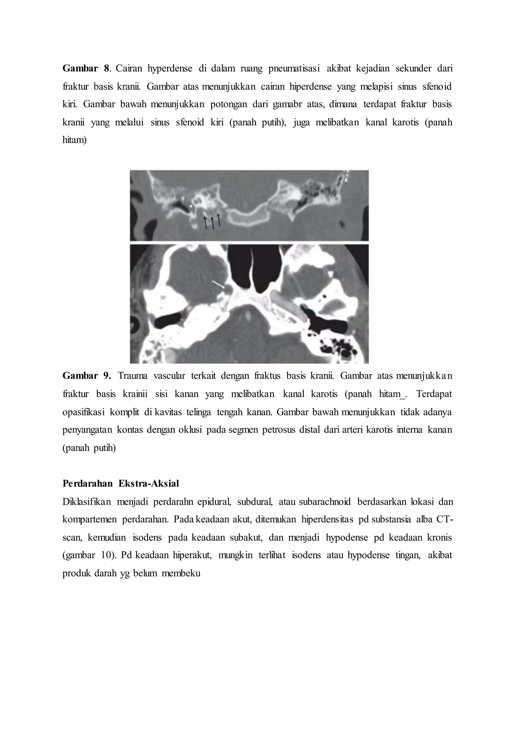 Imaging pediatric head trauma-Indonesia Version | DOCX