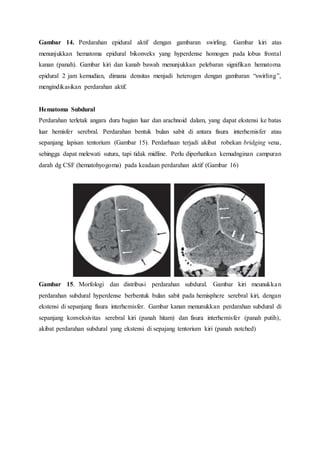 Imaging pediatric head trauma-Indonesia Version | PDF