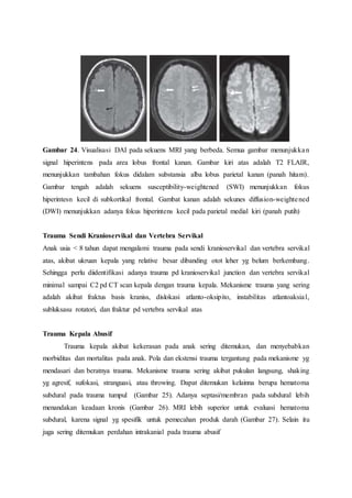 Imaging pediatric head trauma-Indonesia Version | PDF