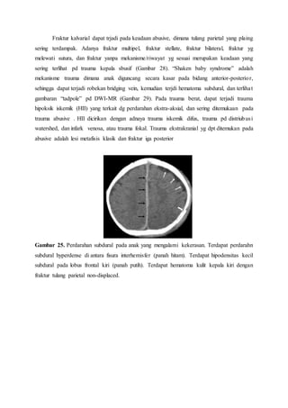 Imaging pediatric head trauma-Indonesia Version | PDF