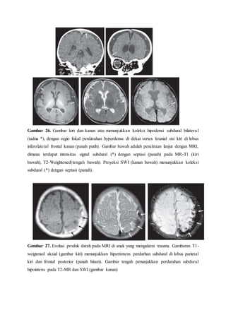 Imaging pediatric head trauma-Indonesia Version | PDF