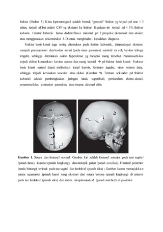 Imaging pediatric head trauma-Indonesia Version | PDF