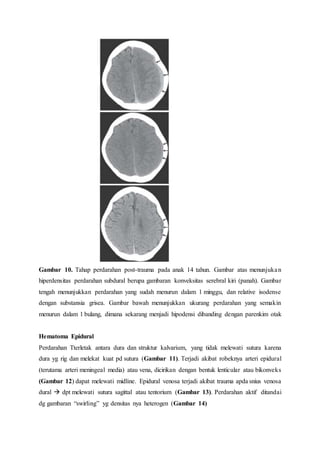 Imaging pediatric head trauma-Indonesia Version | PDF