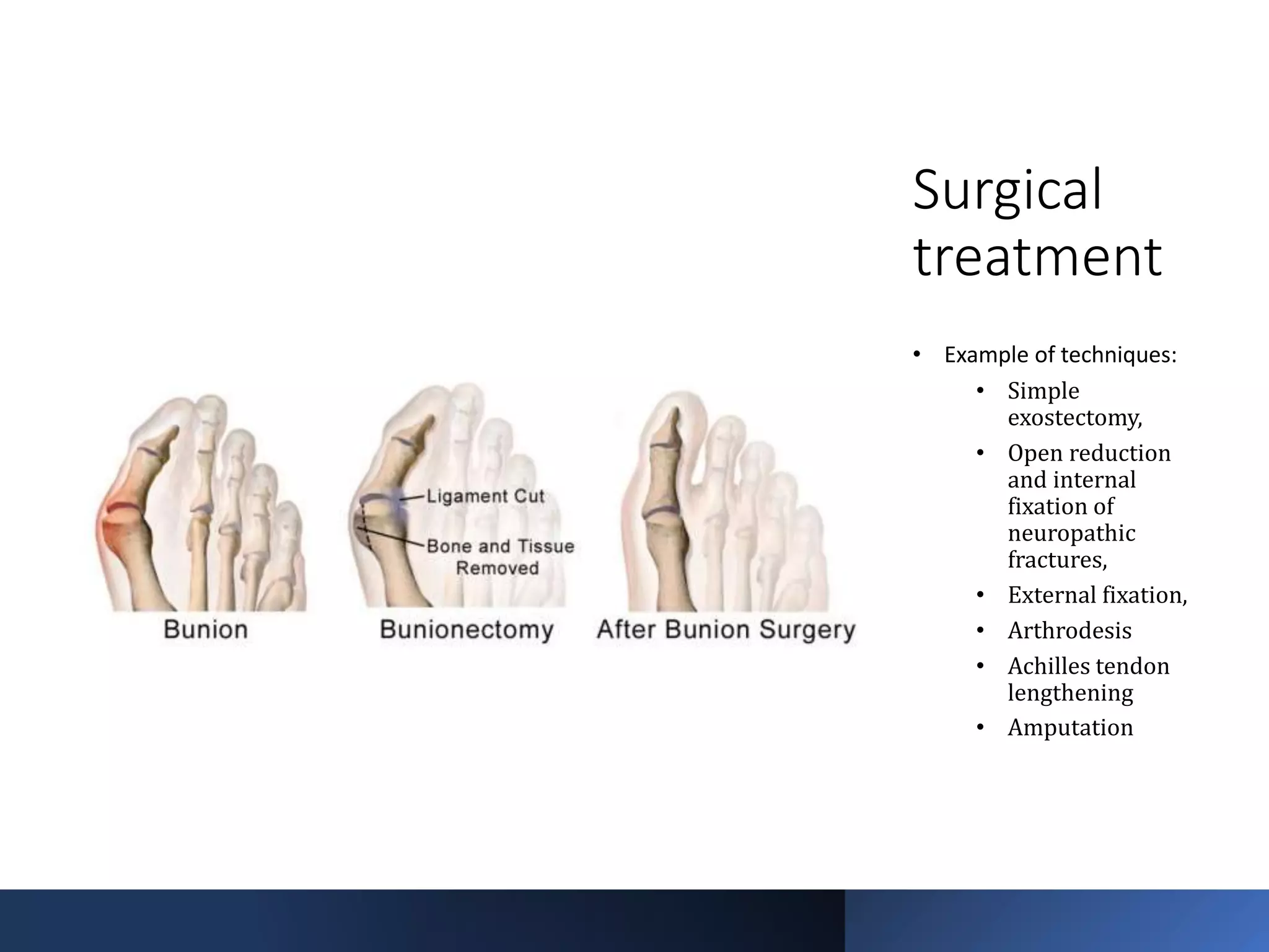 Journal reading New trends in Orthopaedic management of diabetic foot.pptx