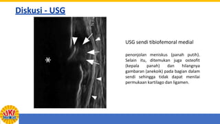 JOURNAL READING OSTEOARTHRITIS RADIO.pptx