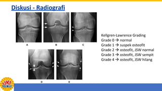 JOURNAL READING OSTEOARTHRITIS RADIO.pptx