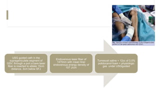 Journal Reading Vascular Surgery - Marlin.pptx