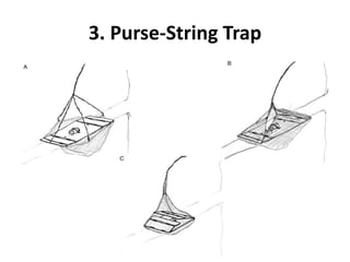 Journal reporting 161 | PPTX