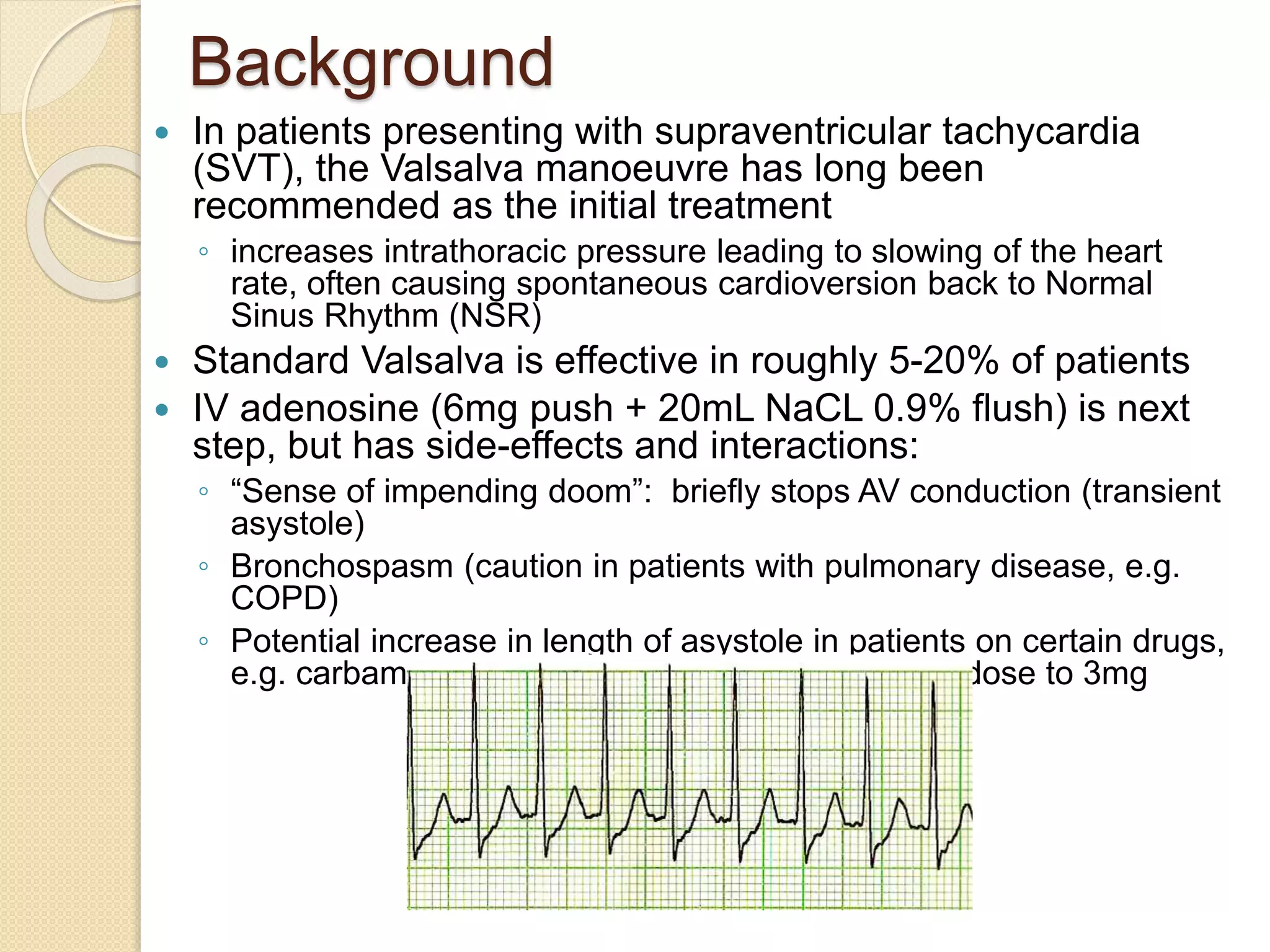 Journal Review - REVERT Trial: Modified Valsalva for Supraventricular ...