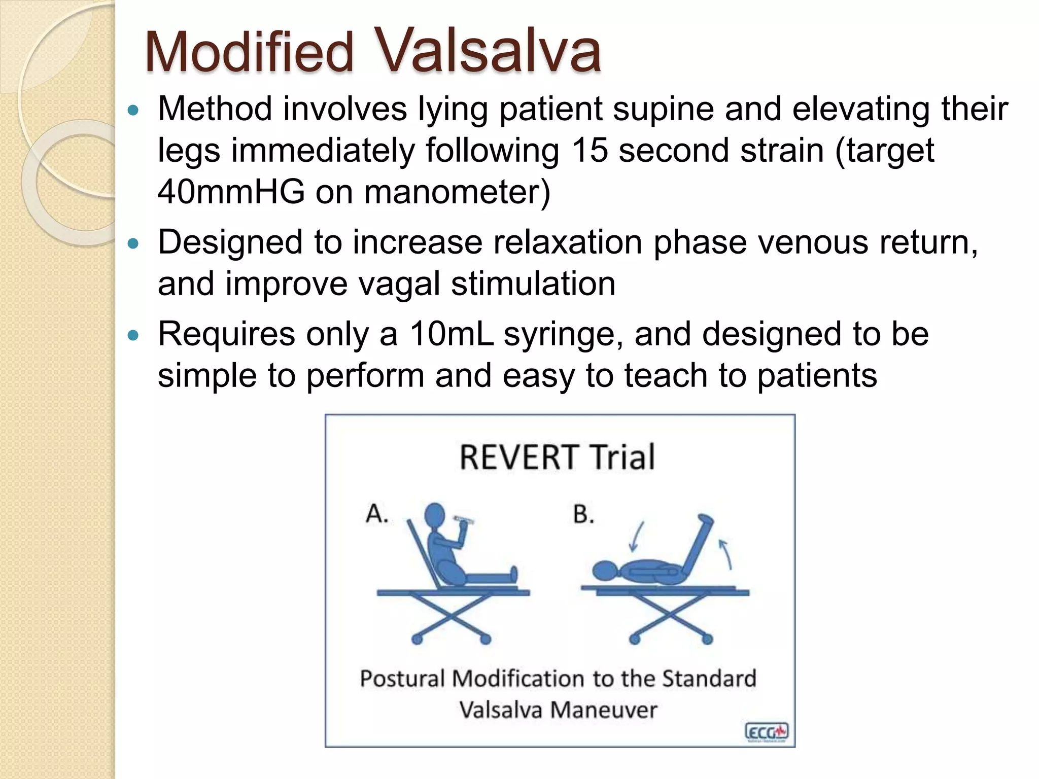 Journal Review - REVERT Trial: Modified Valsalva for Supraventricular ...