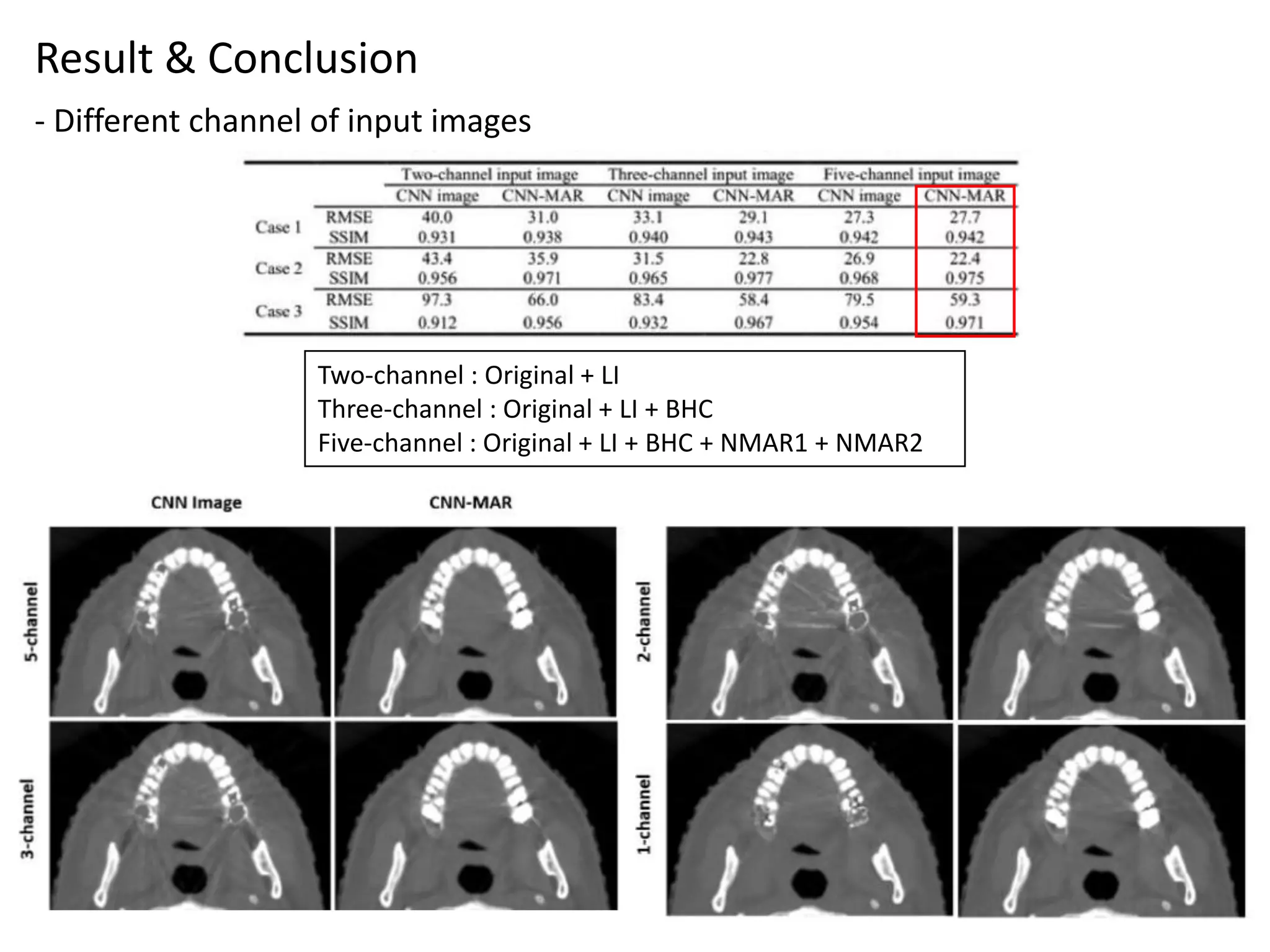 Convolutional Neural Network Based Metal Artifact Reduction In X Ray Computed Tomography Ppt