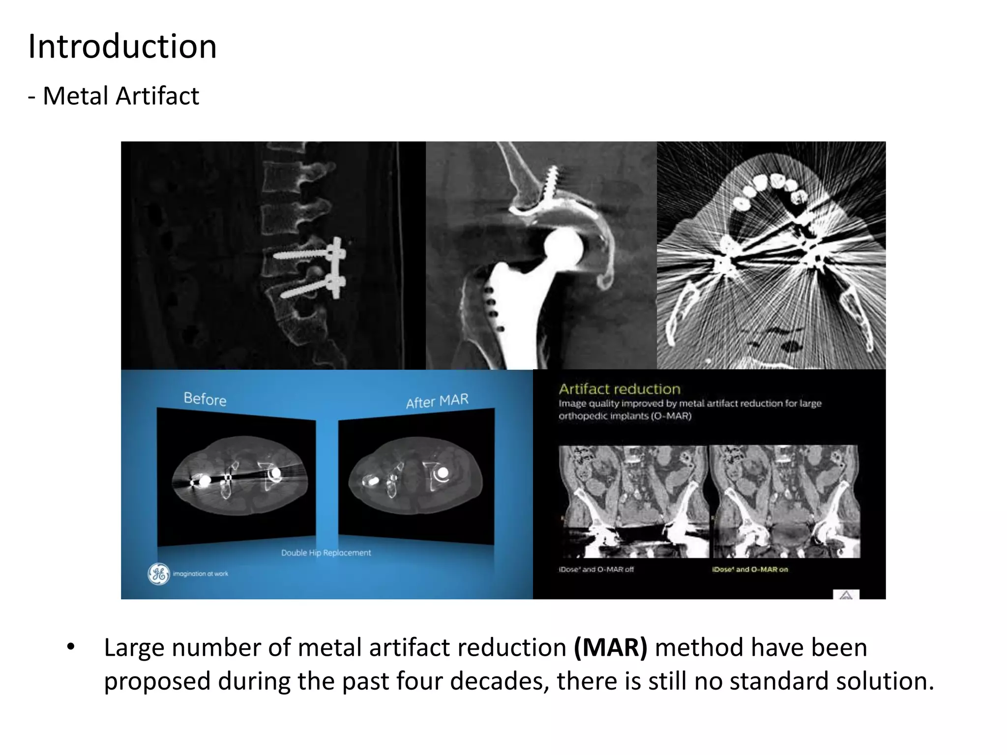 Convolutional Neural Network Based Metal Artifact Reduction In X Ray Computed Tomography Ppt