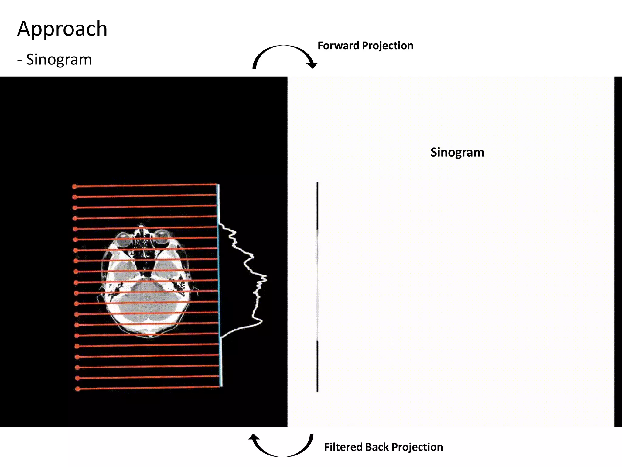 Convolutional Neural Network Based Metal Artifact Reduction In X Ray