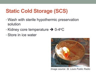 Kidney Preservation: method and trends | PPTX