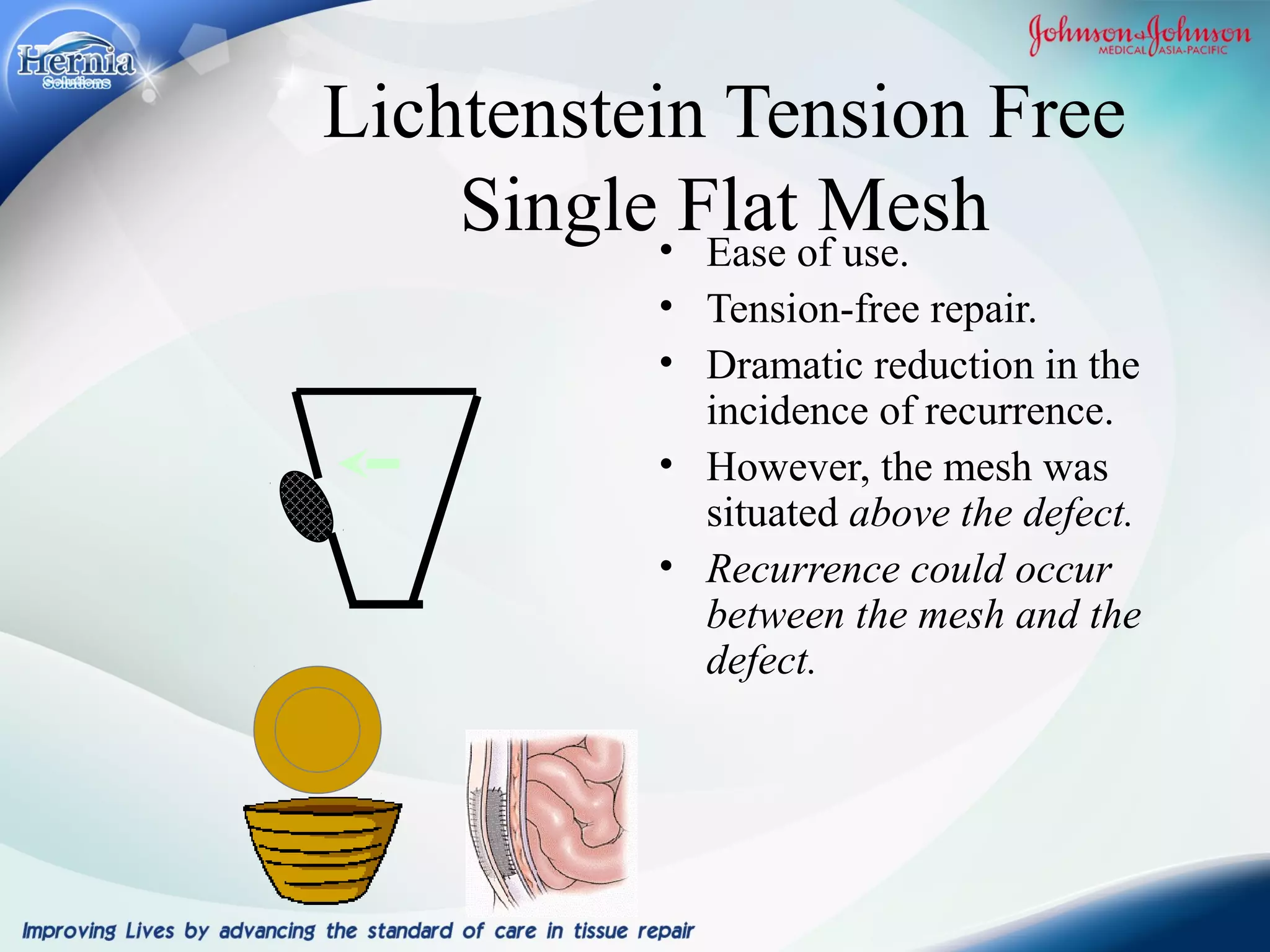 MY JOURNEY WITH HERNIA SURGERY | PPT