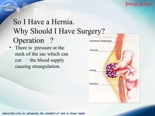 MY JOURNEY WITH HERNIA SURGERY | PPT