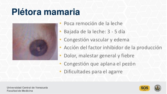 De los pezones rotos a la mastitis. Cómo prevenir y tratar las afecc…