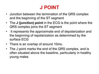 J POINT IN ECG AND ITS INERPRETATION IN ECG | PPTX