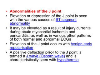 J POINT IN ECG AND ITS INERPRETATION IN ECG | PPTX