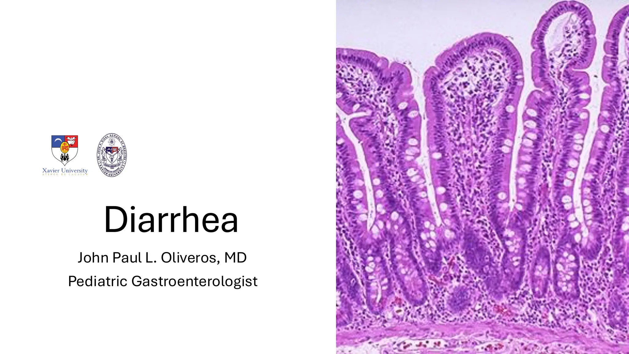 Pediatric Diarrhea Update for year 2025.pdf